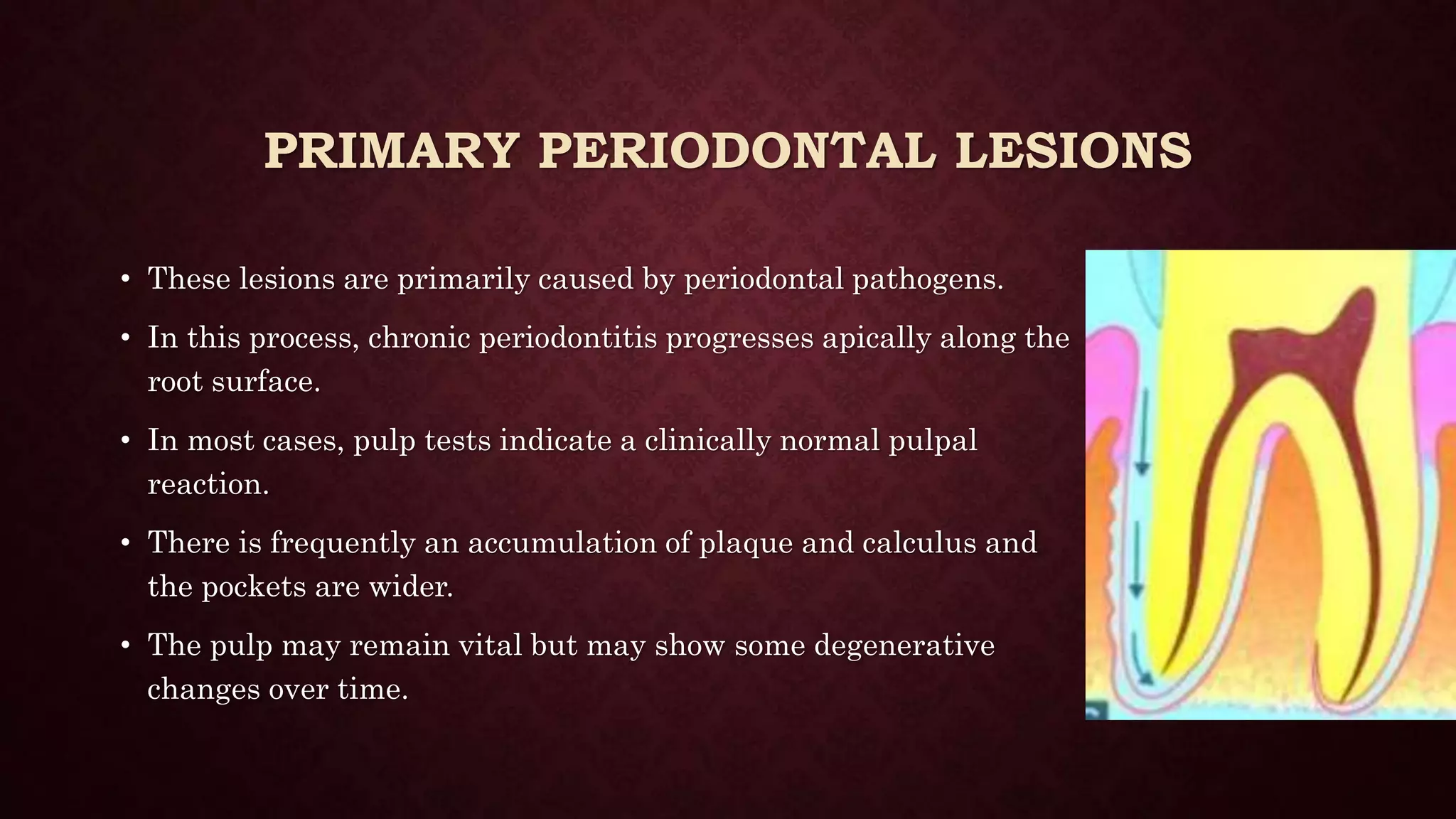 Endo-Perio Lesions | PPTX