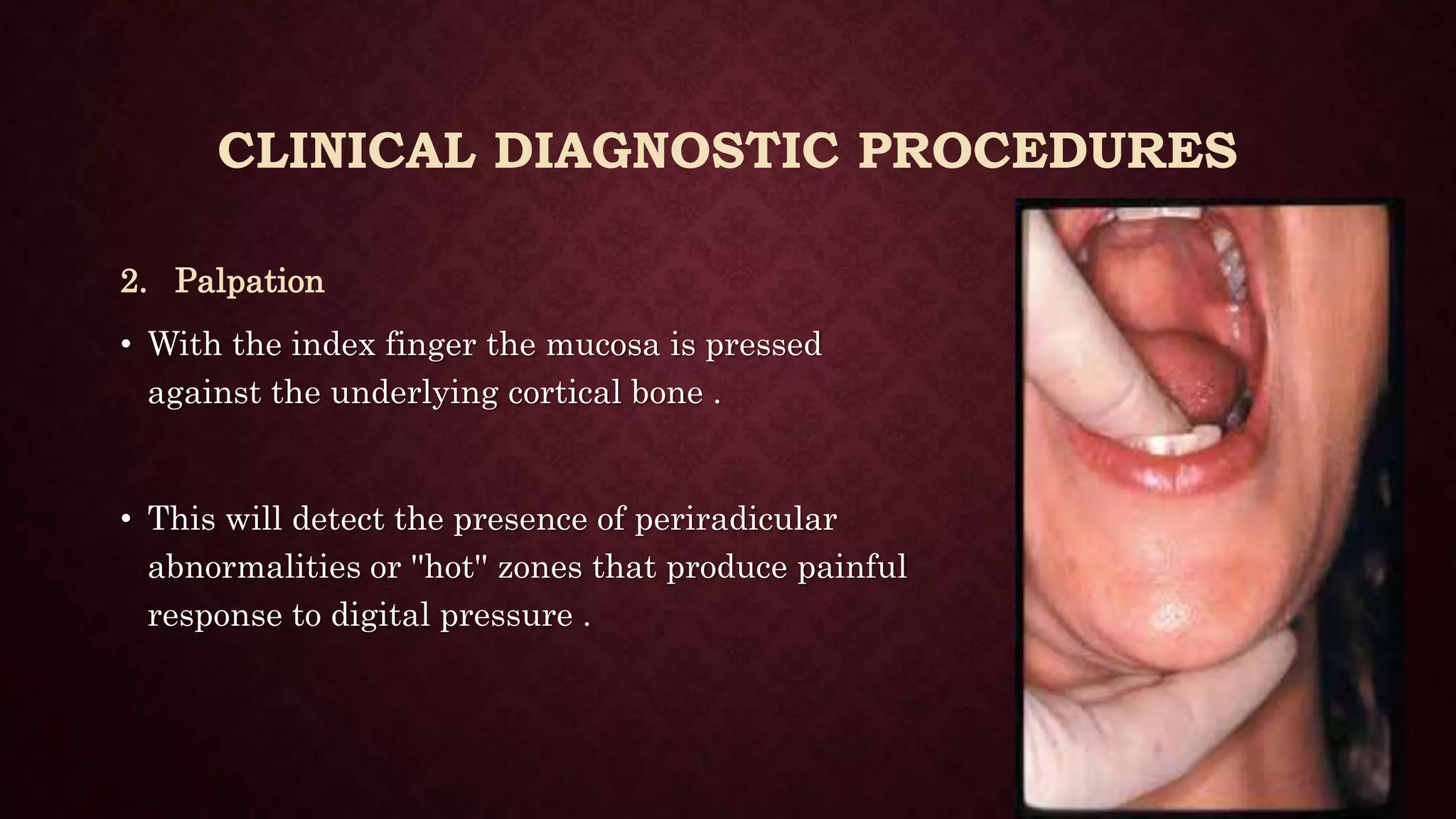 Endo-Perio Lesions | PPTX