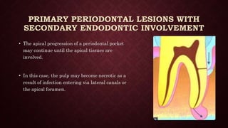 Endo-Perio Lesions | PPTX