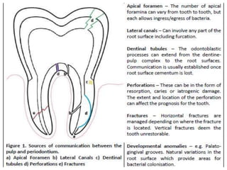PERIO-ENDO LESIONS.pptx | Dental Health | Diseases and Conditions