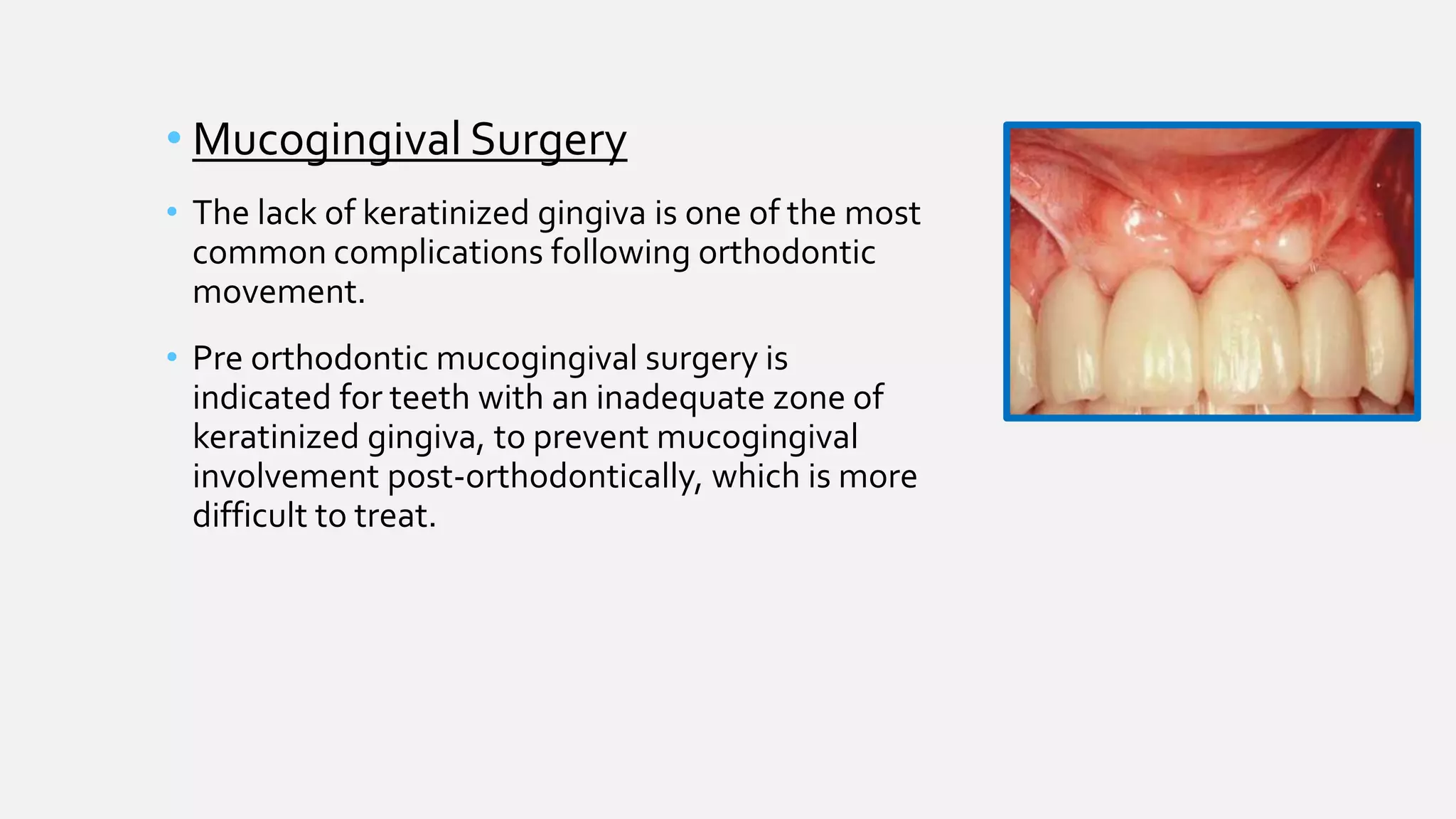 Perio-Ortho.pptx