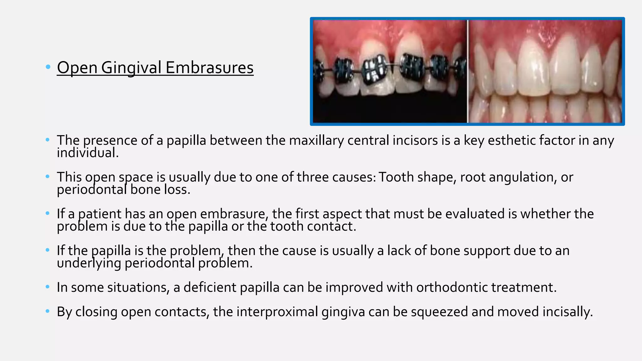 Perio-Ortho.pptx