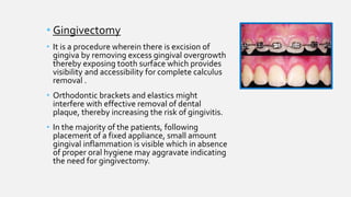 Perio-Ortho.pptx