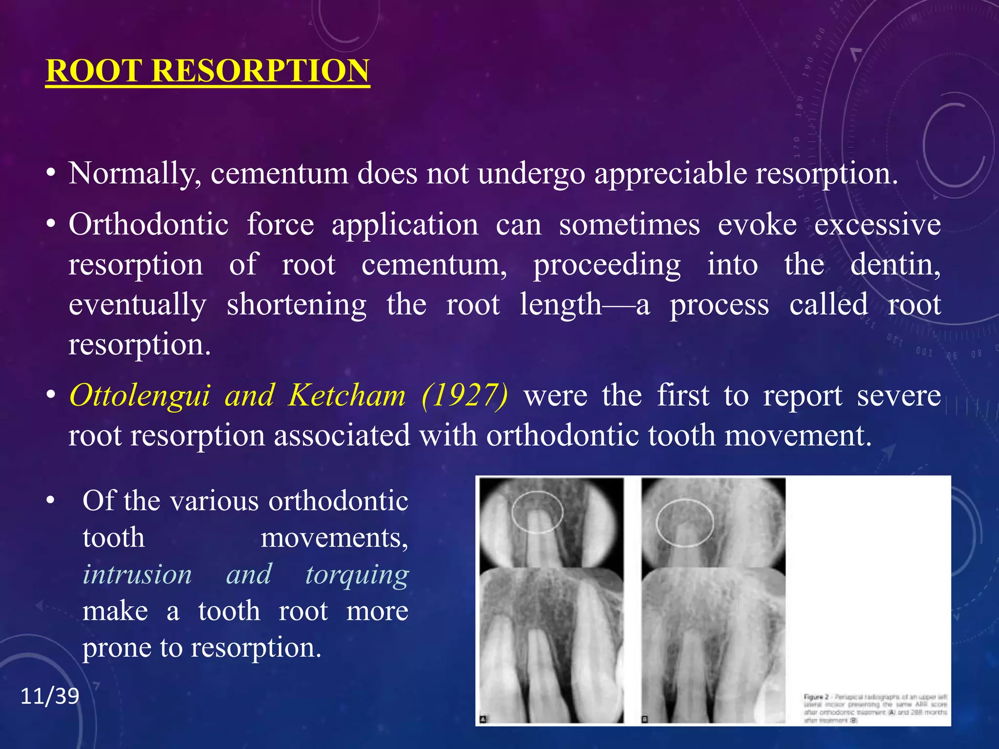 Perio-Ortho interrelationships - Dr.Malvika | PPTX