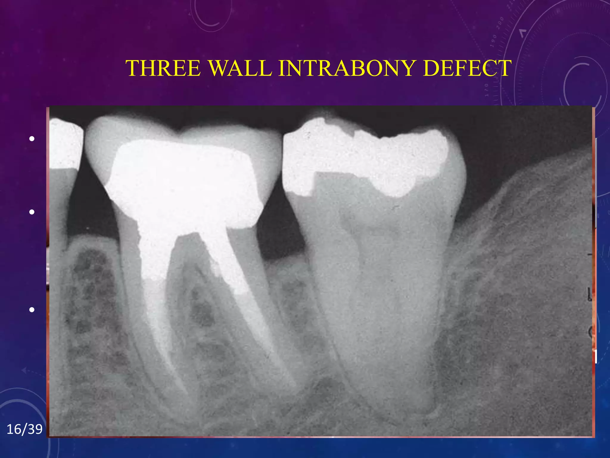 Perio-Ortho interrelationships - Dr.Malvika | PPTX