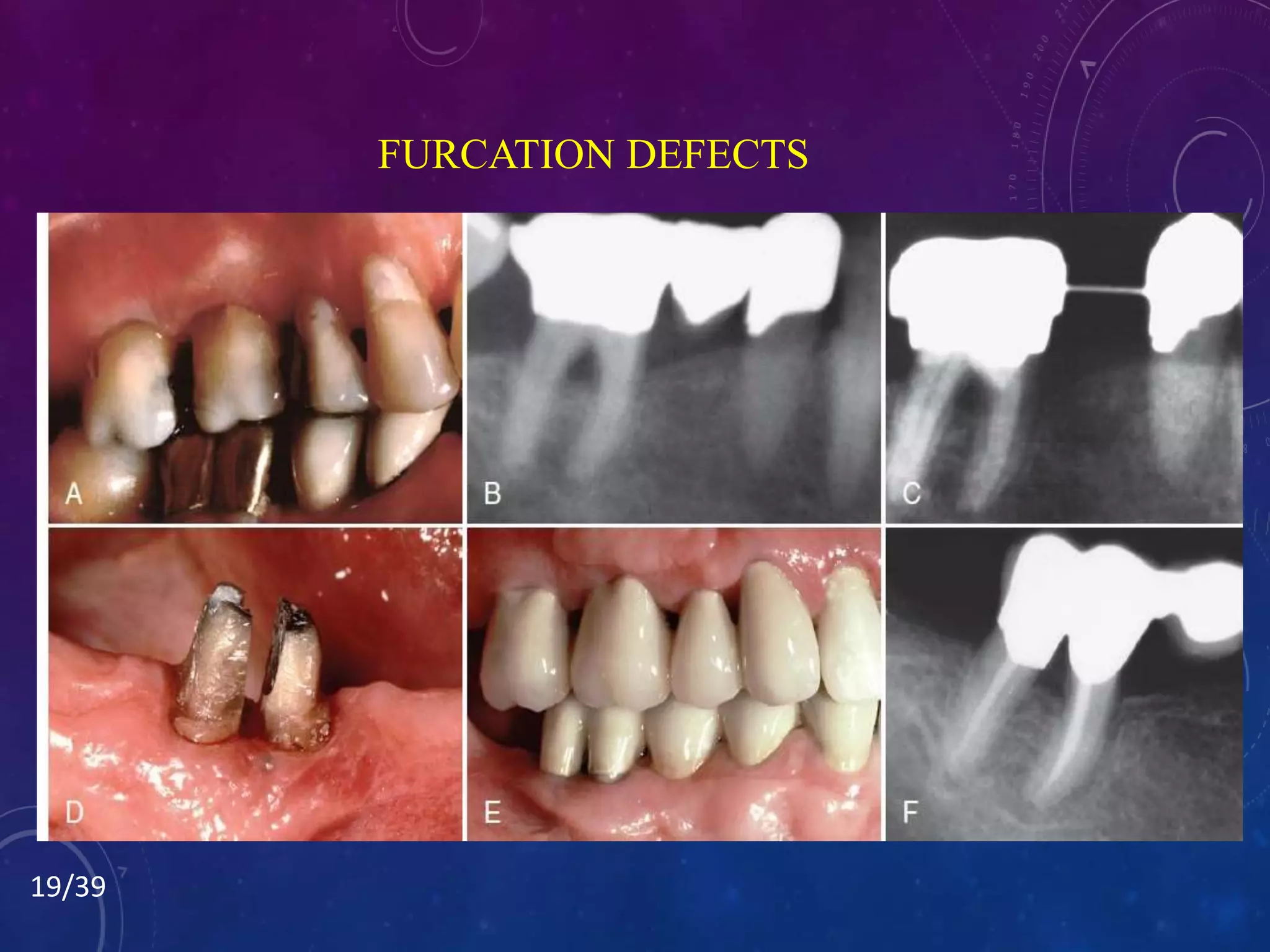 Perio-Ortho interrelationships - Dr.Malvika | PPTX