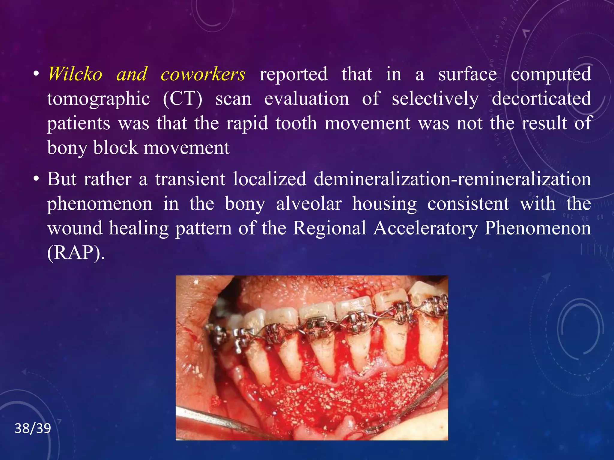 Perio-Ortho interrelationships - Dr.Malvika | PPTX
