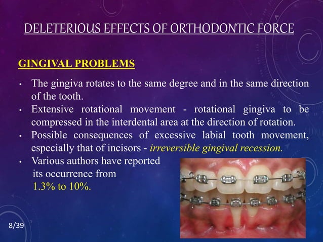 Perio-Ortho interrelationships - Dr.Malvika | PPTX | Oral care ...
