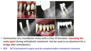Perio ortho relationship | PPTX