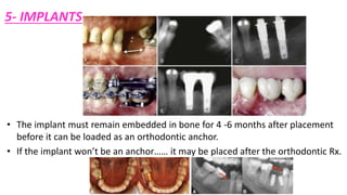 Perio ortho relationship | PPTX