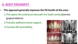 Perio ortho relationship | PPTX