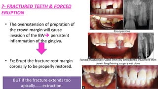 Perio ortho relationship | PPTX