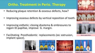 Perio ortho relationship | PPTX