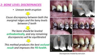 Perio ortho relationship | PPTX
