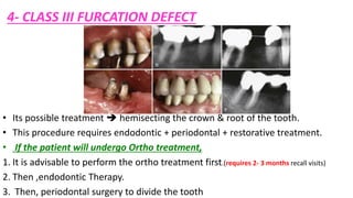Perio ortho relationship | PPTX