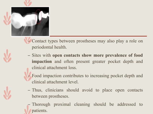 Perio-Prostho.pptx | Oral care | Personal Care