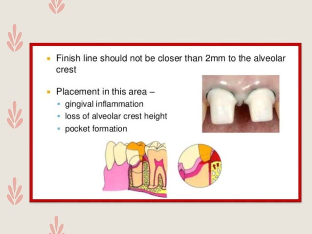Perio-Prostho.pptx | Oral care | Personal Care