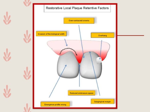 Perio-Prostho.pptx | Oral care | Personal Care