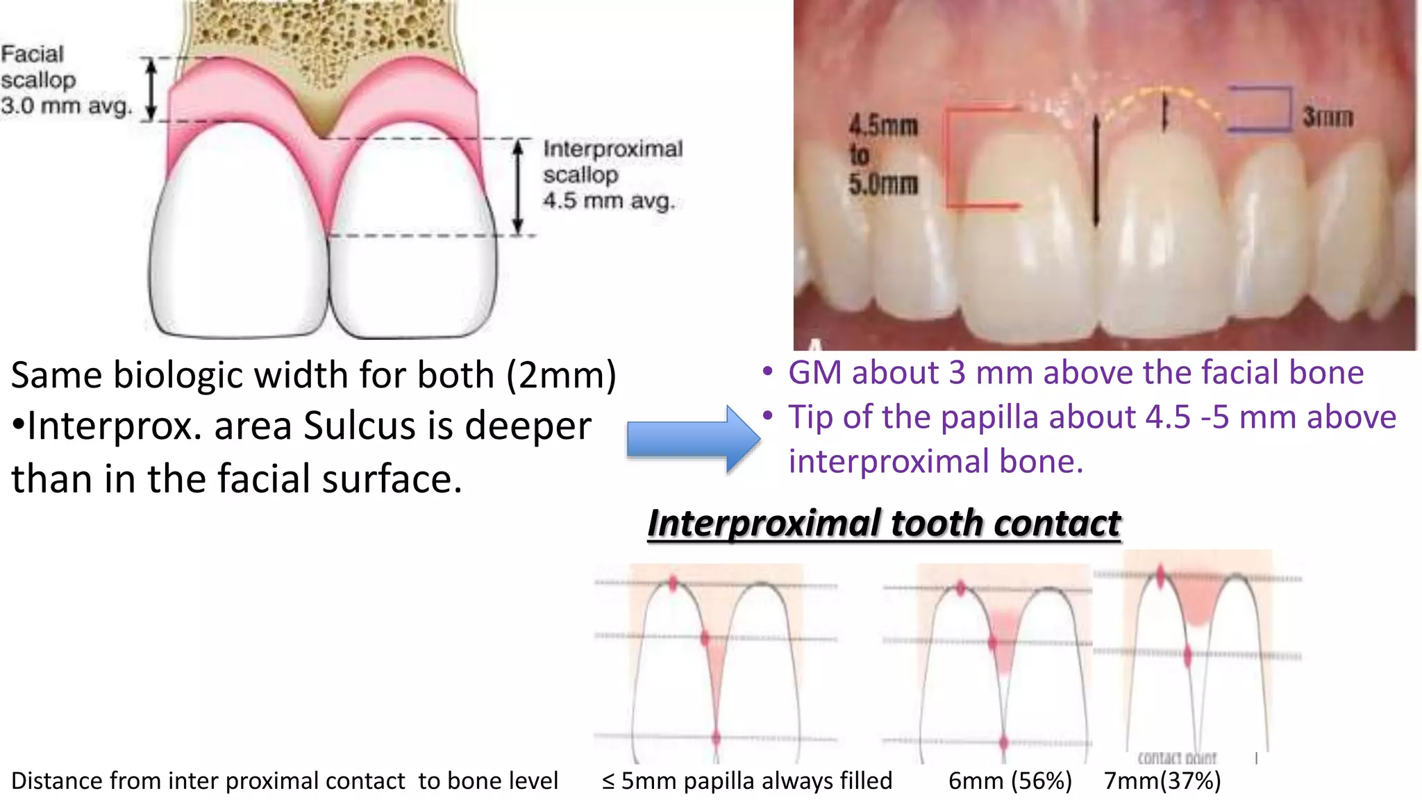 Perio resorative inter-relationship. | PPTX