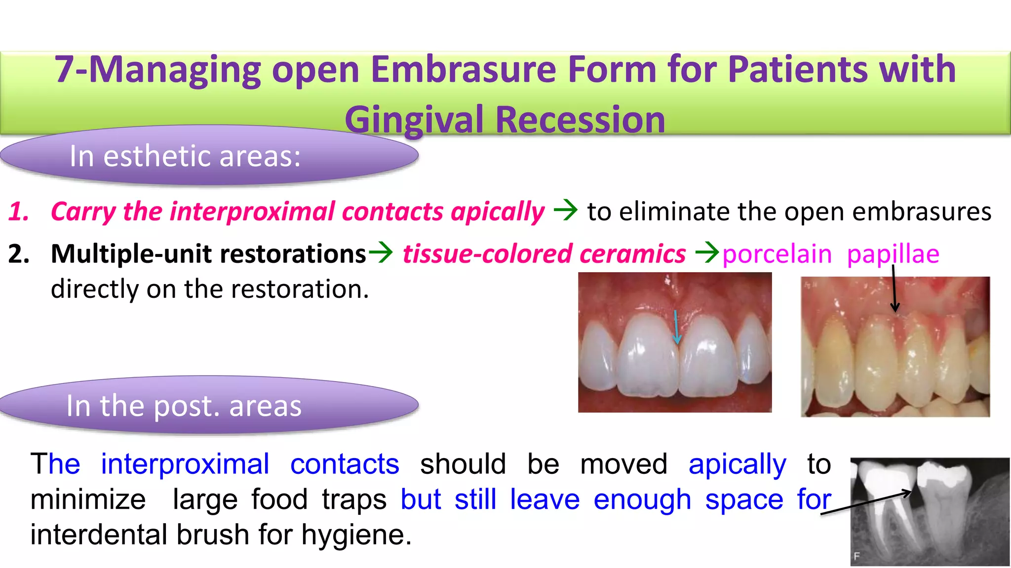 Perio resorative inter-relationship. | PPTX