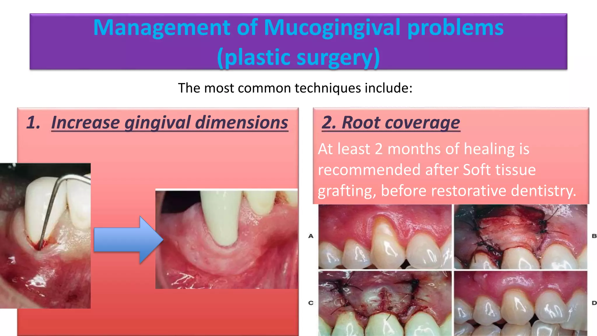 Perio resorative inter-relationship. | PPTX