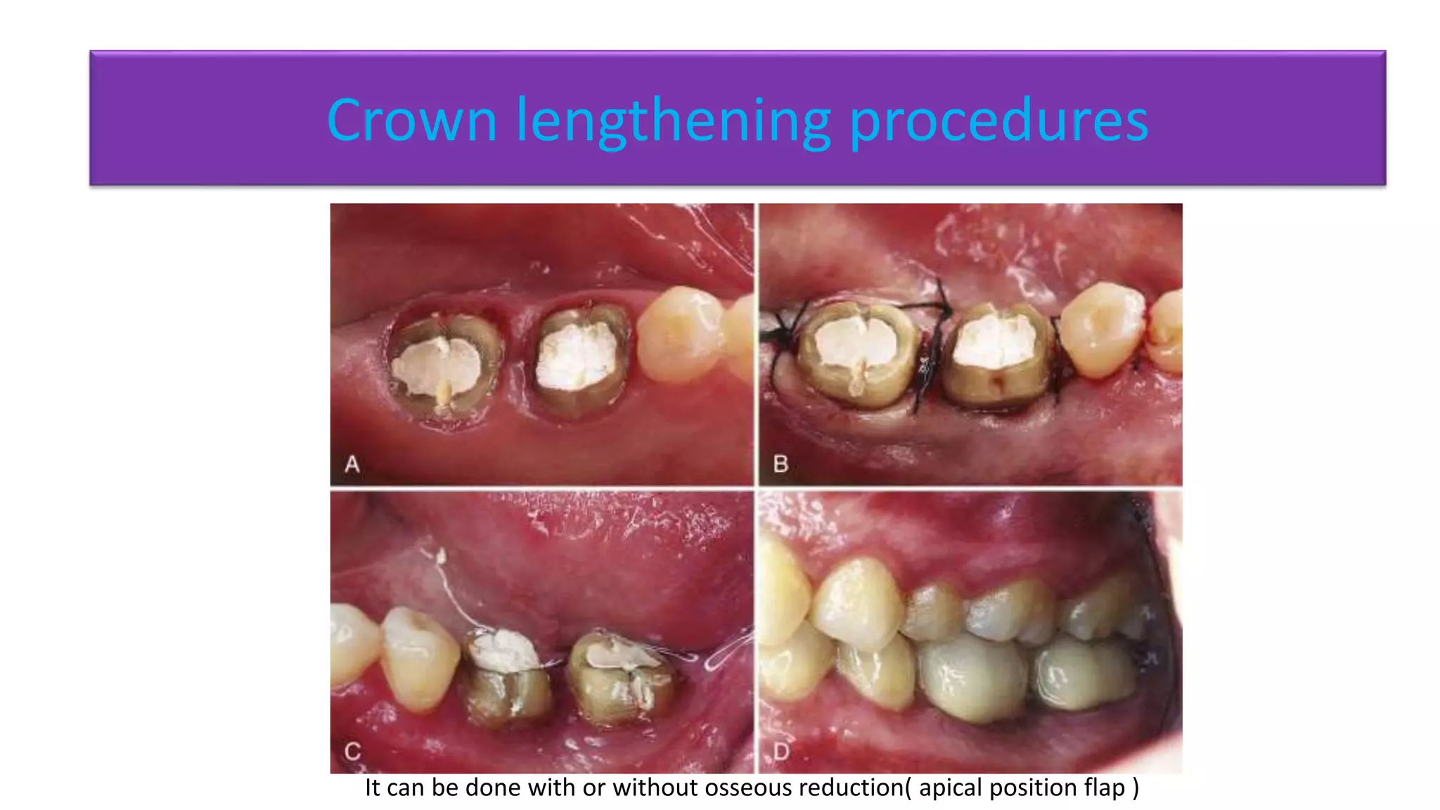 Perio resorative inter-relationship. | PPTX