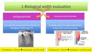 Perio resorative inter-relationship. | PPTX
