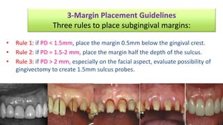 Perio resorative inter-relationship. | PPTX