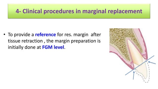 Perio resorative inter-relationship. | PPTX | Oral care | Personal Care