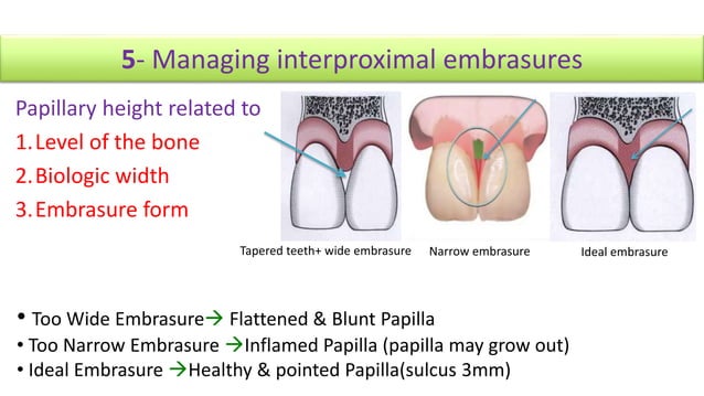 Perio resorative inter-relationship. | PPTX | Oral care | Personal Care