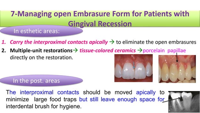 Perio resorative inter-relationship. | PPTX | Oral care | Personal Care