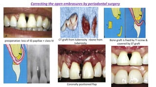 Perio resorative inter-relationship. | PPTX