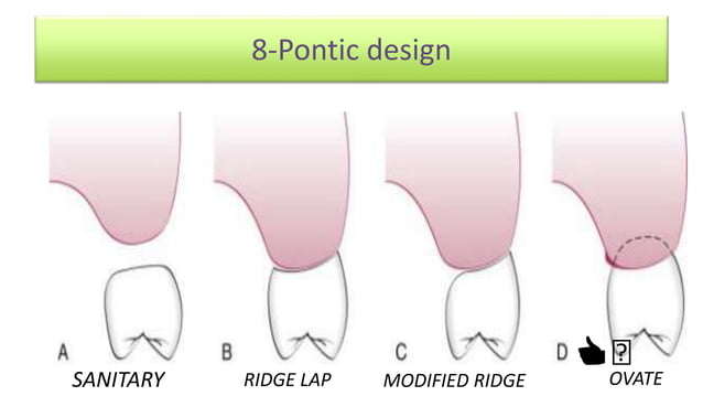 Perio resorative inter-relationship. | PPTX | Oral care | Personal Care