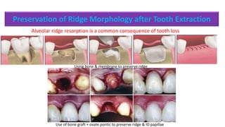 Perio resorative inter-relationship. | PPTX