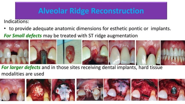 Perio resorative inter-relationship. | PPTX | Oral care | Personal Care