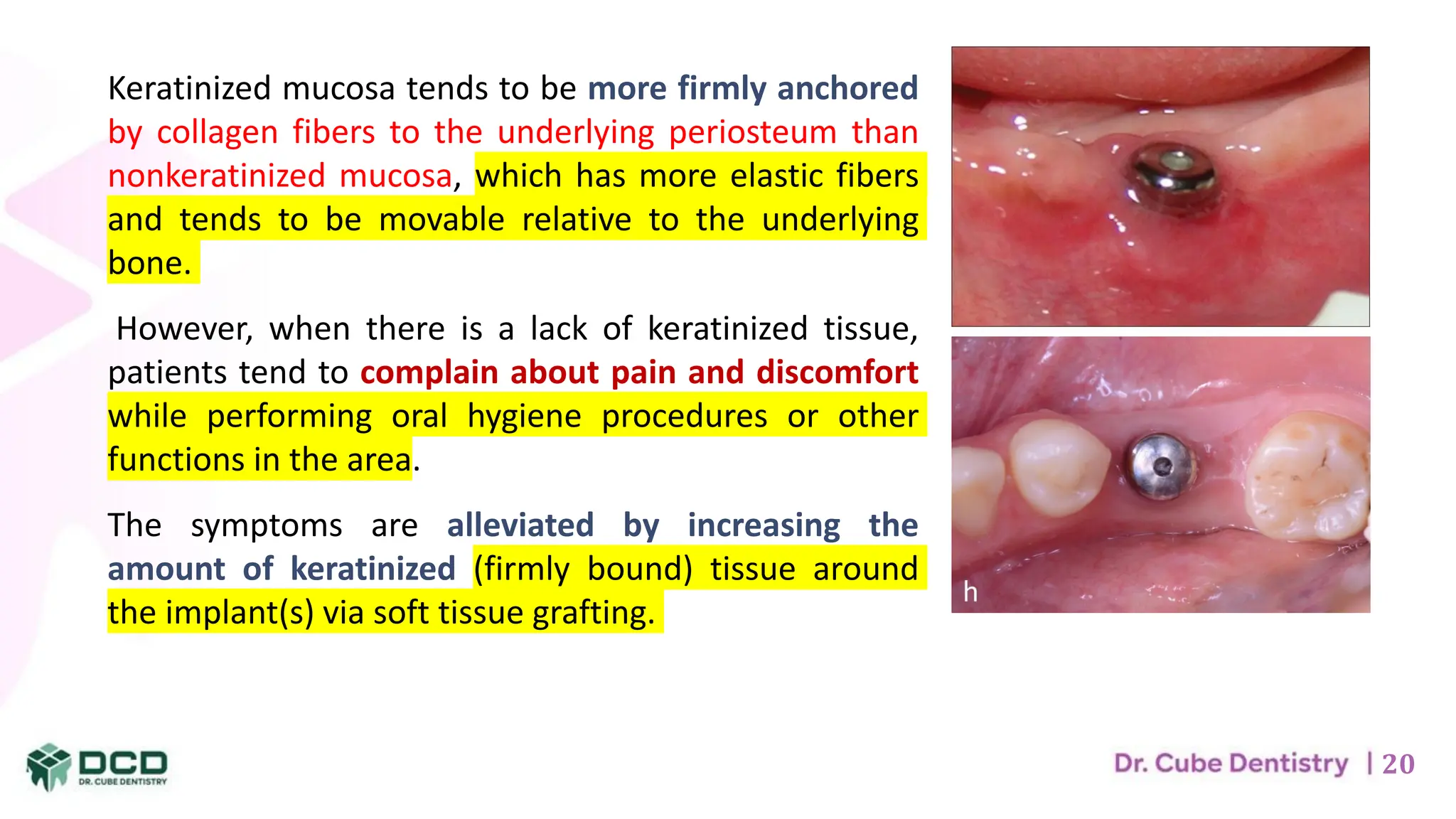 Perio5 Lec.17 Mucosa- Implant Interface.pdf
