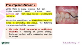 Perio5_Lec_18_Peri_implant_diseases_classification,_cases_definition.pptx