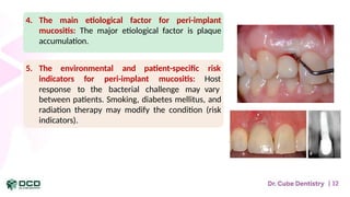 Perio5_Lec_18_Peri_implant_diseases_classification,_cases_definition.pptx