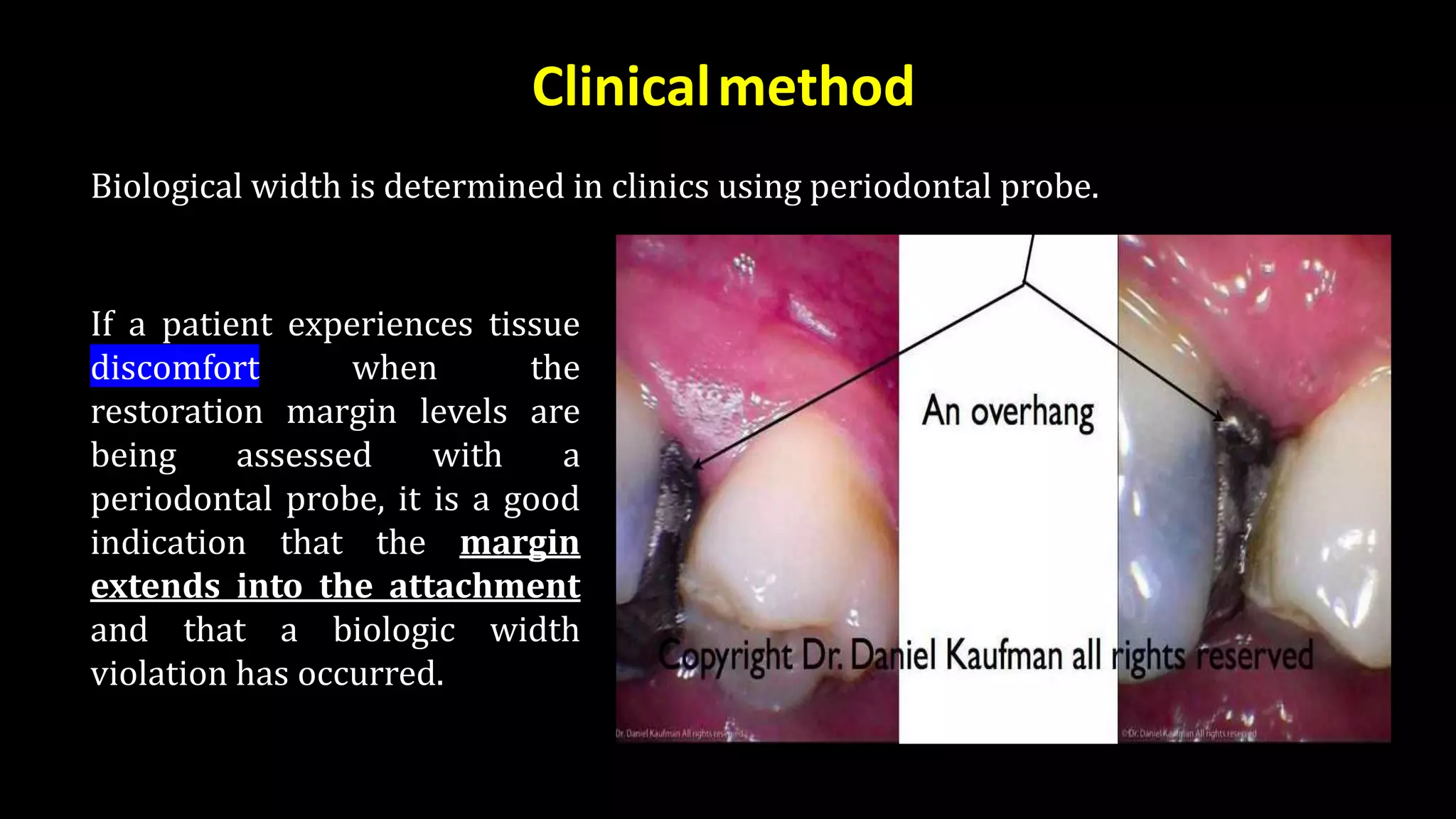 Biological width by Dr.Ali Mohammed AbuTrab | PPTX
