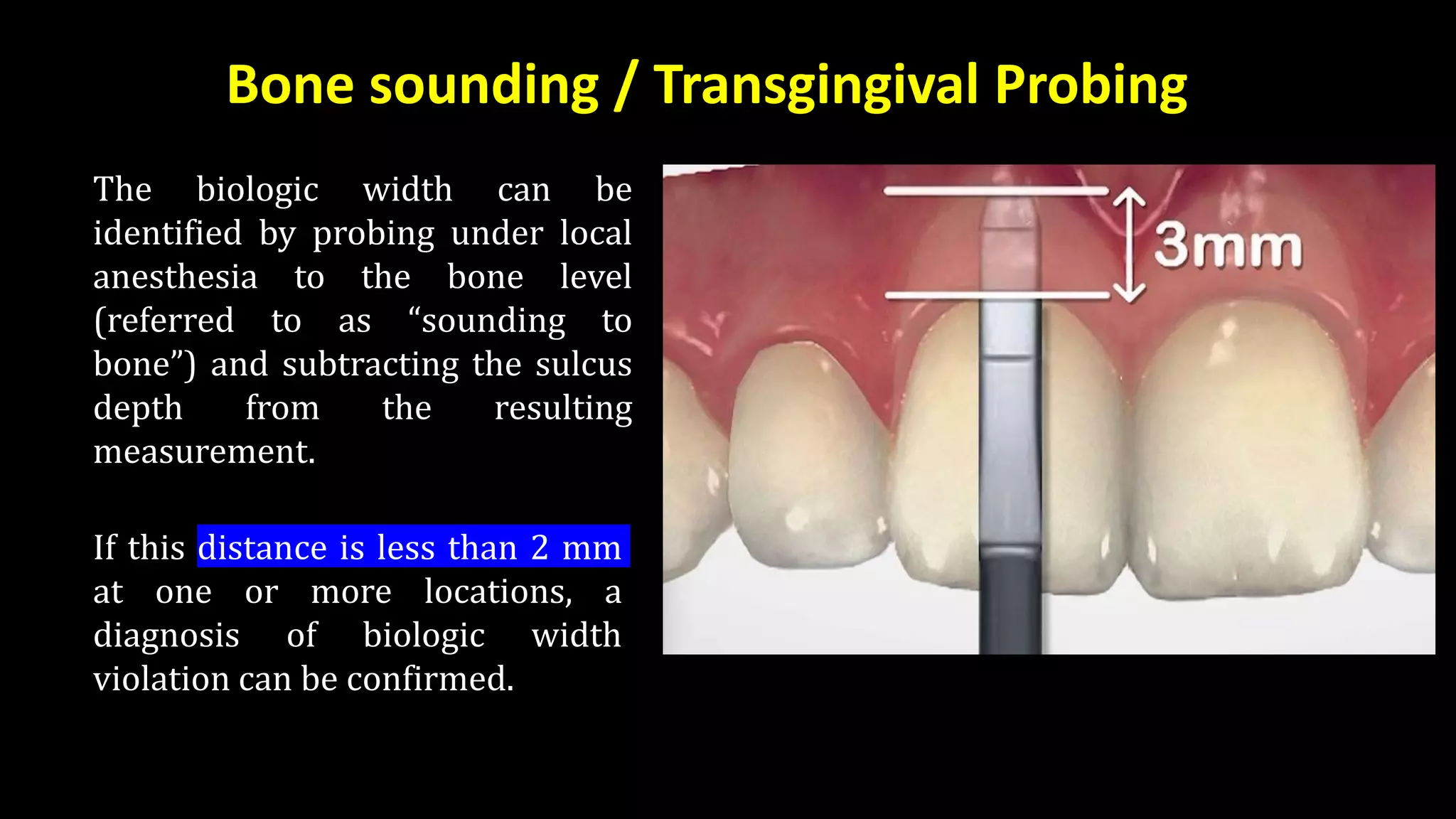 Biological width by Dr.Ali Mohammed AbuTrab | PPTX