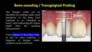 Biological width by Dr.Ali Mohammed AbuTrab | PPTX