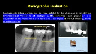 Biological width by Dr.Ali Mohammed AbuTrab | PPTX