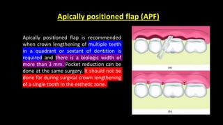 Biological width by Dr.Ali Mohammed AbuTrab | PPTX