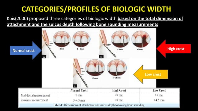 Biological width by Dr.Ali Mohammed AbuTrab | PPTX