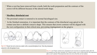 PERIO CONSIDERATIONS IN prosthodontics ppt | PPTX
