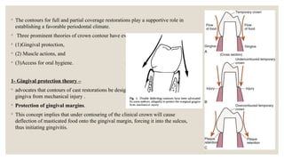 PERIO CONSIDERATIONS IN prosthodontics ppt | PPTX