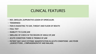 PERIOCORONITIS, AN ACUTE GINGIVAL INFECTION. | PPT