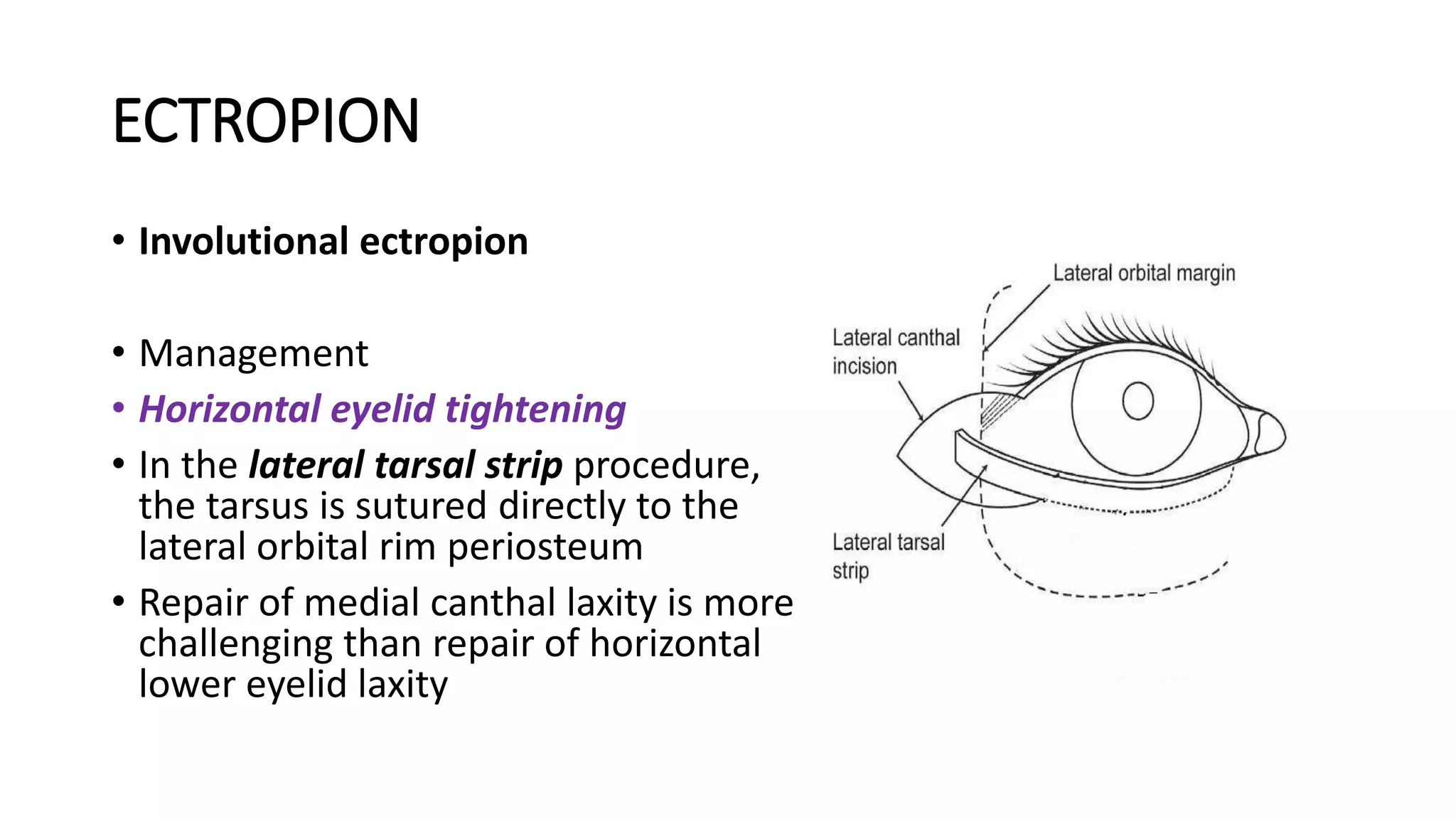 PERIOCULAR MALPOSITIONS AND INVOLUTIONAL CHANGES.pptx