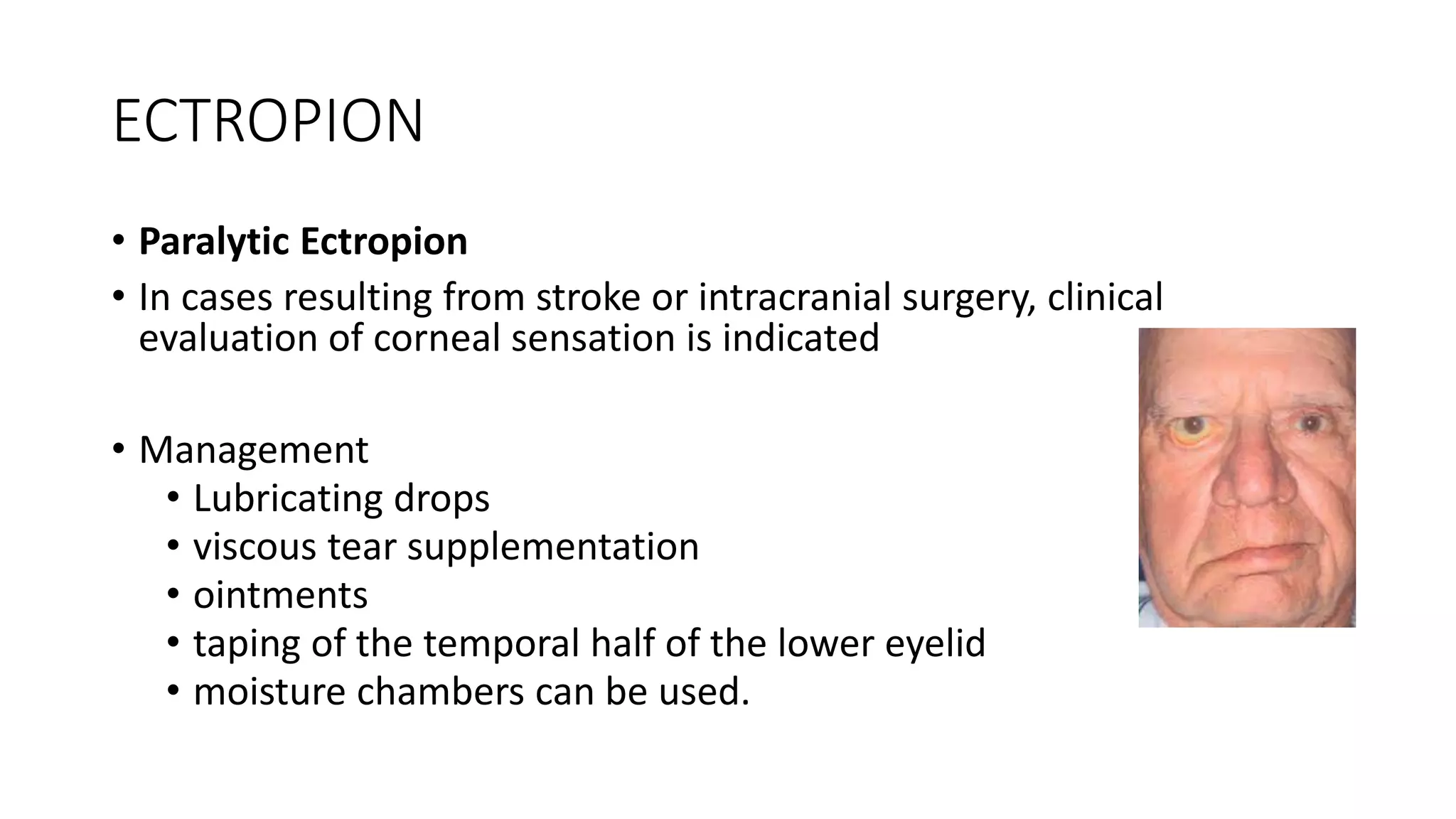 PERIOCULAR MALPOSITIONS AND INVOLUTIONAL CHANGES.pptx