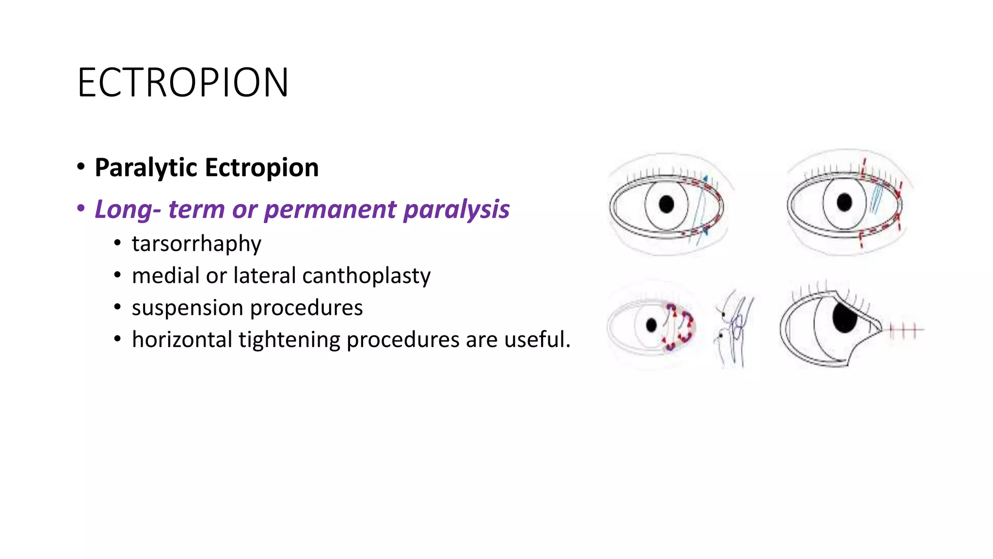 PERIOCULAR MALPOSITIONS AND INVOLUTIONAL CHANGES.pptx